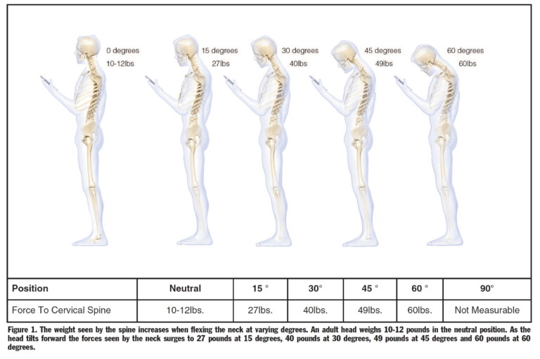 Fix Forward Head Posture with Pandiculation - Somatic Movement Center