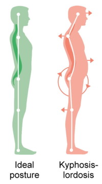 How to Get Rid of Your Chronic Neck Pain: Pandiculate!