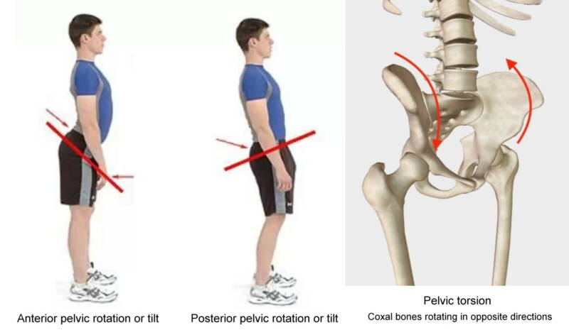 How To Fix Pelvic Torsion Twisted Pelvis With Clinical Somatics Exercises Somatic Movement