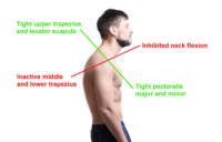 How to Resolve Upper Crossed Syndrome with Clinical Somatics Exercises ...
