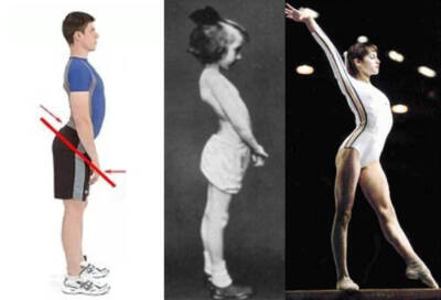 Full-Body Patterns of Tension That Involve the Iliopsoas - Somatic ...
