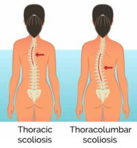 How to Relieve Shallow Breathing - Somatic Movement Center