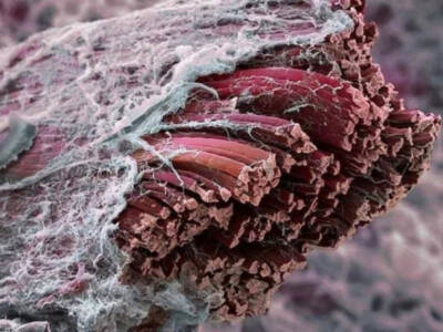 How Does Fascia Affect Our Pain and Mobility? - Somatic Movement Center